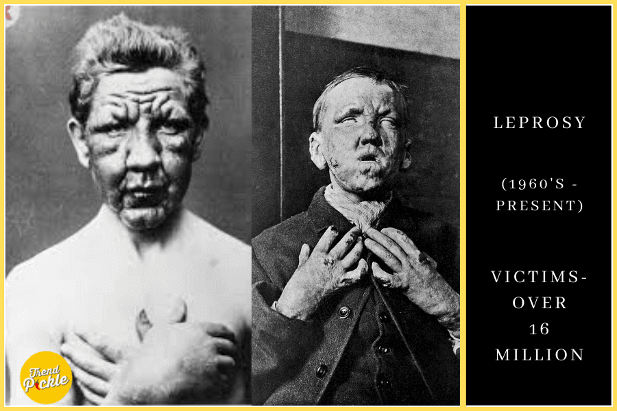 Top 10 Deadliest Epidemics In History - Trendpickle